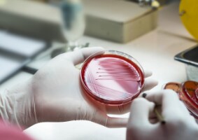 Micro MIC Results for Critical Patients | Fisher Healthcare